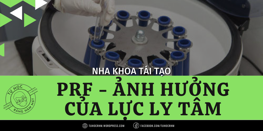 Lực ly tâm và ảnh hưởng của nó đến PRF - Tự học RHM